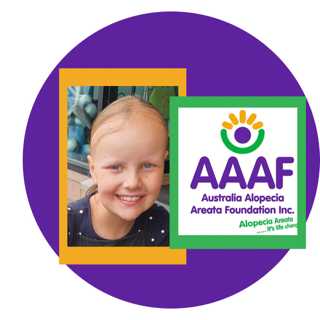 Australia Alopecia Areata Foundation | Amy McPhee